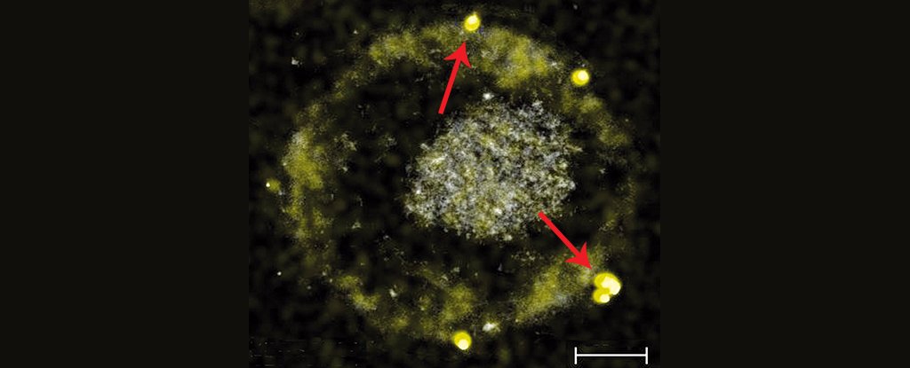 These Bacteria Digest Toxic Metals And Poop Out Tiny Gold Nuggets ...