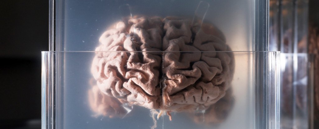 We Just Found a Genetic Key to Why Humans Have Such Massive Brains ...