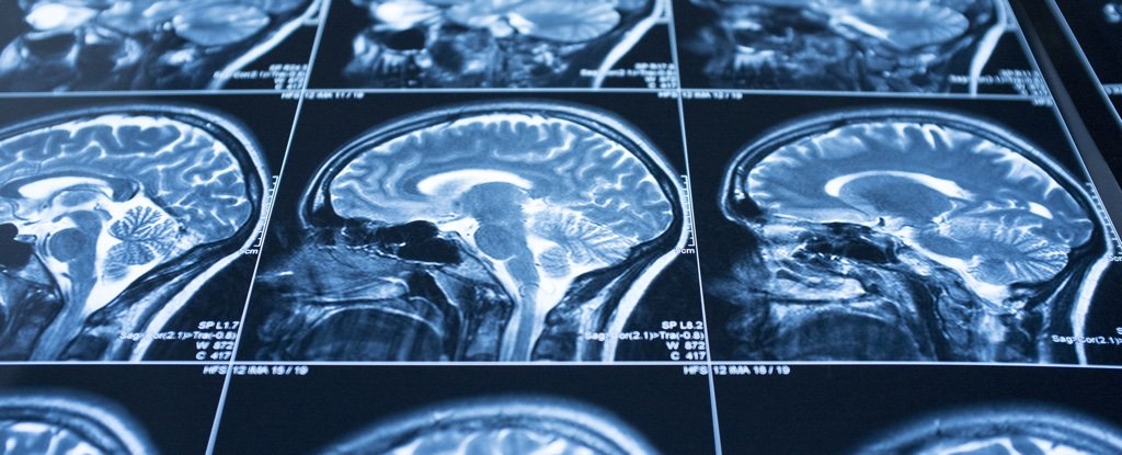 Scientists Just Discovered How Water Gets From Blood Into The Brain ...