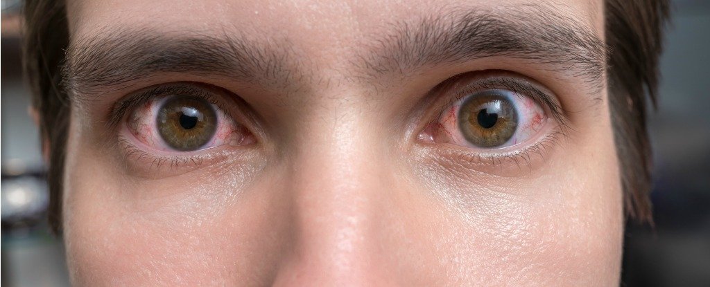 Are Eye Twitches Anything to Worry About, And What Can You Do About ...