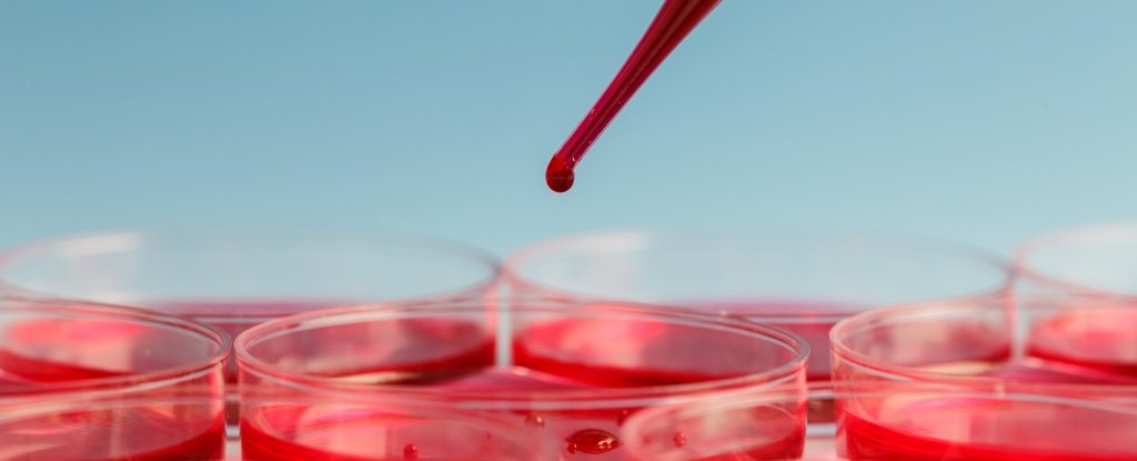 Incredible New Test Can Screen Your Blood For Every Single Known ...