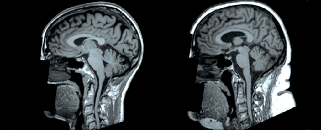 We Now Have More Evidence of a Worrying Link Between Obesity And ...