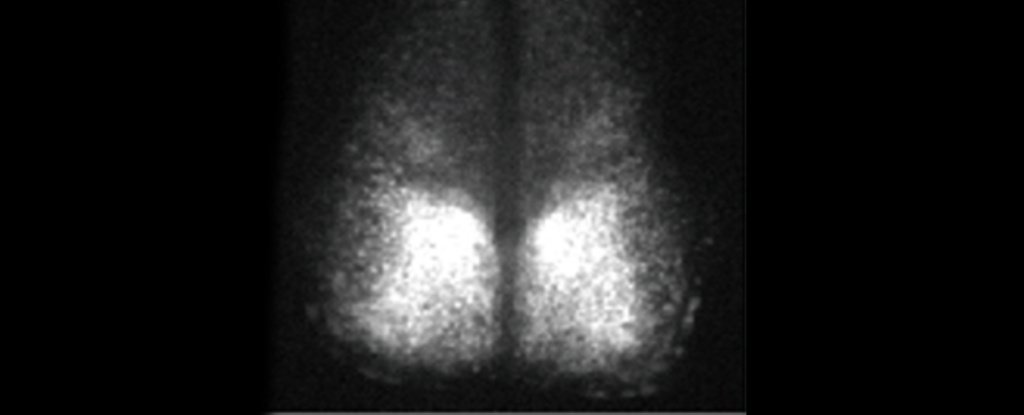 Scientists Have Successfully Kept Mouse Brain Tissue Alive in The Lab ...