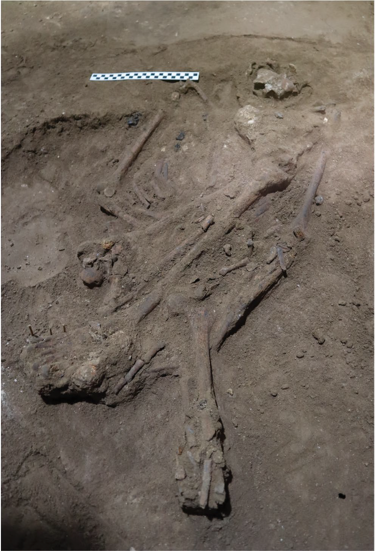 World's Oldest Evidence of Surgical Amputation Lay Hidden For 31,000 ...