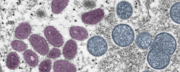 Los Angeles Death May Be The First Confirmed Monkeypox Fatality in The ...