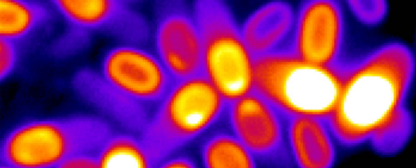 Unexpected Activity in 'Dead' Bacteria Detected by Scientists ...