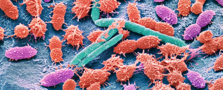 Newly Discovered Gut Microbe Could Be a Trigger For Rheumatoid ...