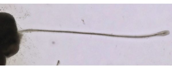 Scientists Grow Fully Functioning Hair Follicles in New Lab First ... Scientists Grow Fully Functioning Hair Follicles in New Lab First ...