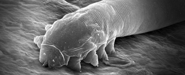 Your Face Is Covered in Thousands of These, And They're Not Always Nice ...