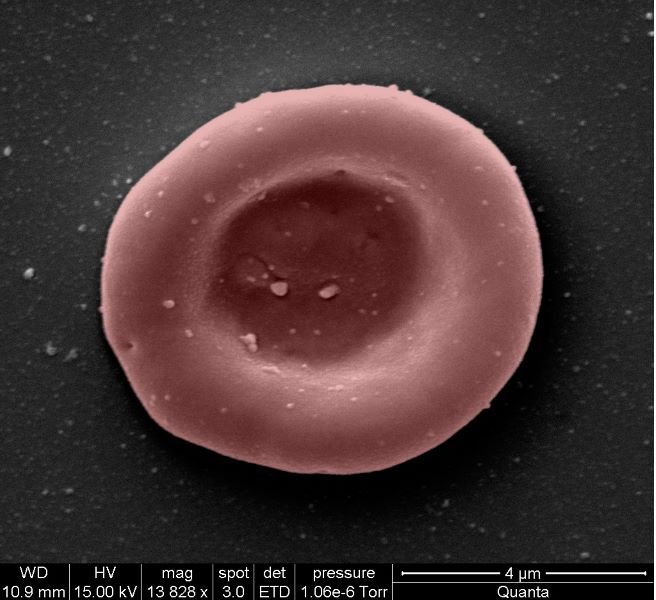 World-First Trial Transfusing Lab-Grown Red Blood Cells Begins ...