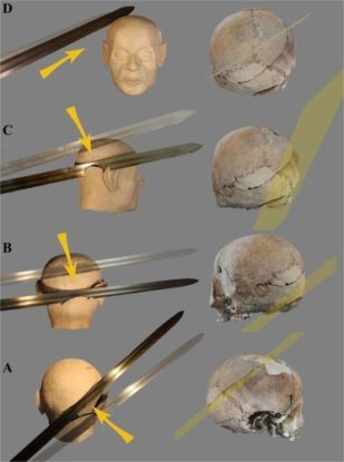 Shattered Skull Details Gruesome Final Moments of a Medieval Murder ...