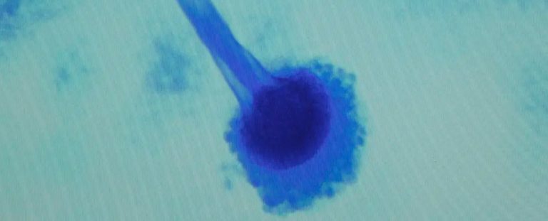 Could 'The Last of Us' Ever Happen? The Real Risks of a Fungus Pandemic ...