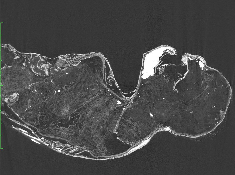 We Finally Know What Japan's Eerie Mummified Mer-Monkey Really Is ...