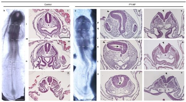 Nanoplastics Interfere With Developing Chicken Embryos in Terrifying ...