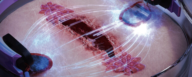 Scientists Use Electricity to Make Wounds Heal 3x Faster : ScienceAlert