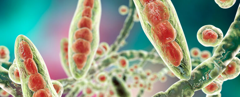 CDC: First US Cases of Severe Drug-Resistant Ringworm Identified ...