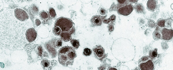 Most of Us Carry a Virus Few Have Heard of. Here's Why It's Important ...