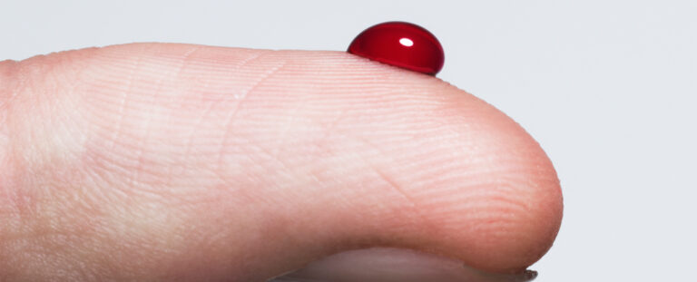 Scientists Identify How Young Blood Reverses Aging in Human Skin Cells ...