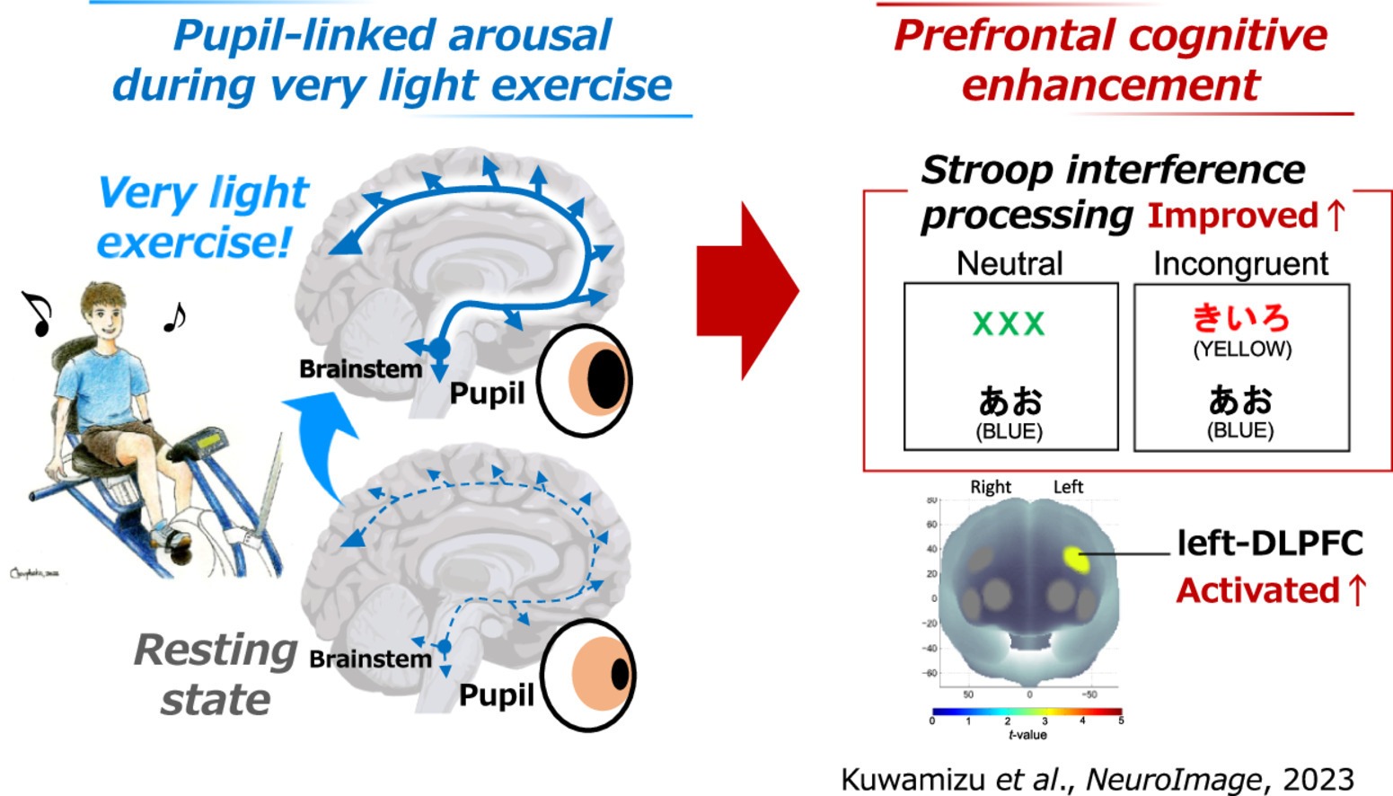 Your Pupils Can Reveal a Hidden Signal About Your Brain Function ...