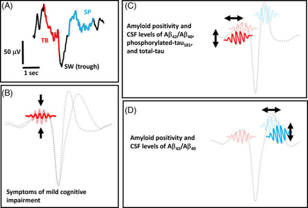 A High-Tech Headband Could Detect Early Signs of Alzheimer's in Your ...