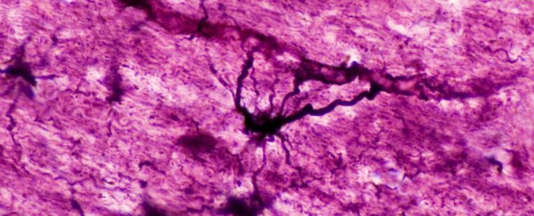 Strange 'Hybrid' Brain Cells Have Been Discovered Hiding Inside Our ...