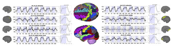 Scientists Find Powerful, Unexplained Signals in The Brain's White ...