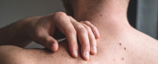 Surprise Finding: The Deadliest Form of Skin Cancer Isn't Melanoma ...
