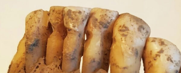 Scientists Studied 3,000 Viking Teeth And Discovered Surprisingly ...