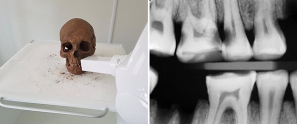 Scientists Studied 3,000 Viking Teeth And Discovered Surprisingly ...