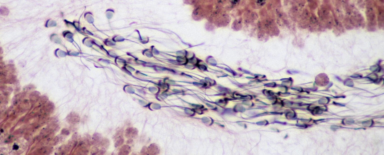 The Semen Microbiome Is a Thing, And It Might Be Impacting Fertility ...