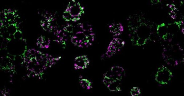 Obesity Disrupts Mitochondria, And We May Have Figured Out How ...