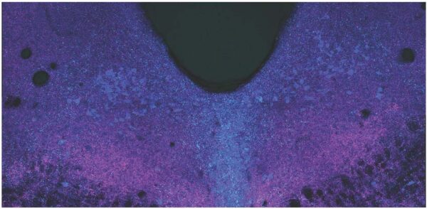 Scientists Discovered a 'Fear Switch' in The Brain, And How to Turn It ...