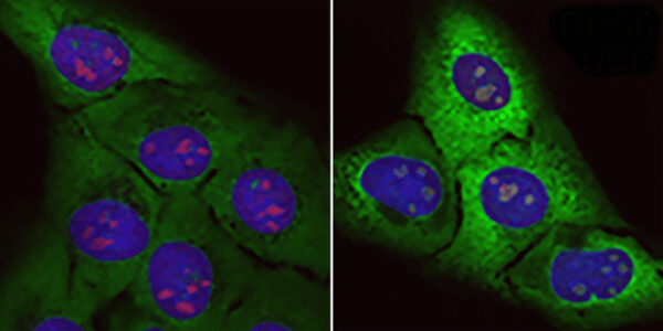 Hoarding Junk Proteins Could Increase Our Risk of ALS : ScienceAlert