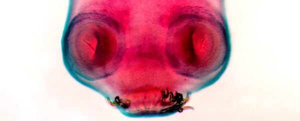 Robert F. Kennedy Jr. Says a Worm Ate Part of His Brain. Can That ...