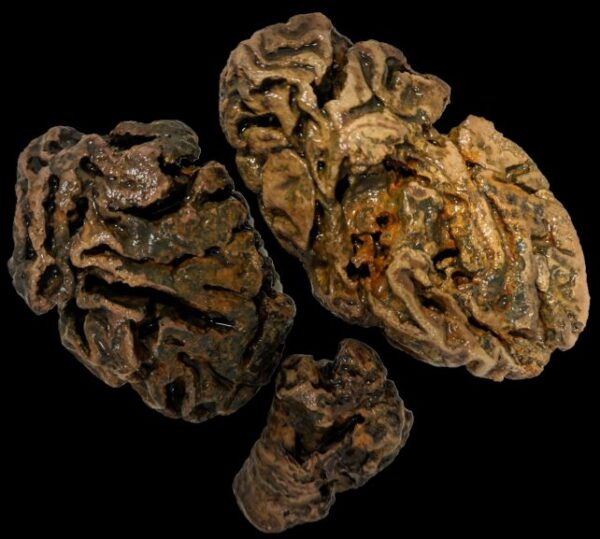12,000-Year-Old Preserved Human Brains Defy Soft Tissue Decay ...