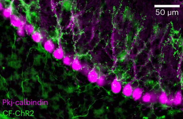 Mysterious 'Zombie Neurons' Unlock Secrets of Learning in The Brain ...