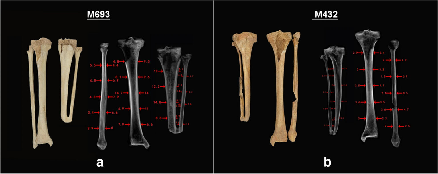 2,500-Year-Old Skeletons With Matching Injuries Reveal Grisly ...