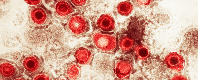 Oldest Known Human Viruses Found in 50,000-Year-Old Neanderthal Bones ...