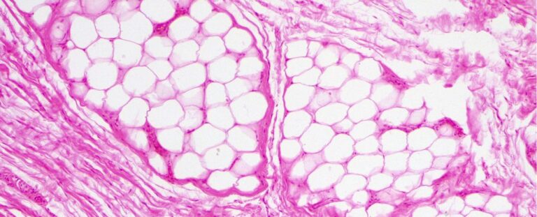 Mouse Experiment Uncovers a Crucial Switch That Breaks Down Fat For ...