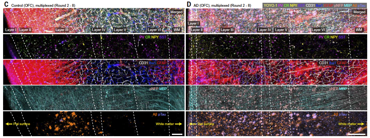 Amazing New Technique Images Alzheimer's Brain Changes at Every Level ...