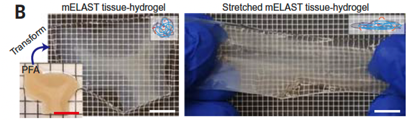Amazing New Technique Images Alzheimer's Brain Changes at Every Level ...