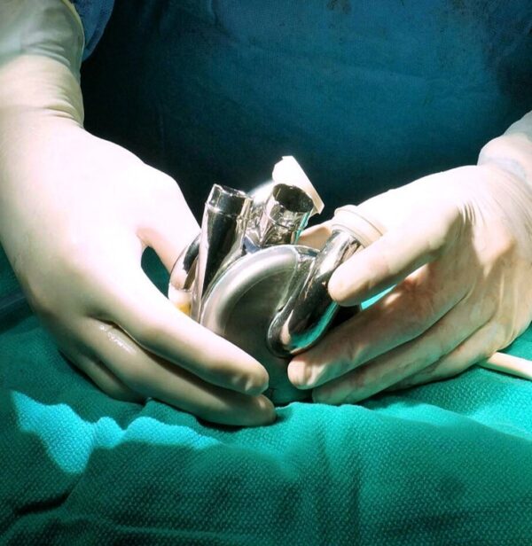 World First: Heart Made From Titanium Kept a Man Alive For Days ...