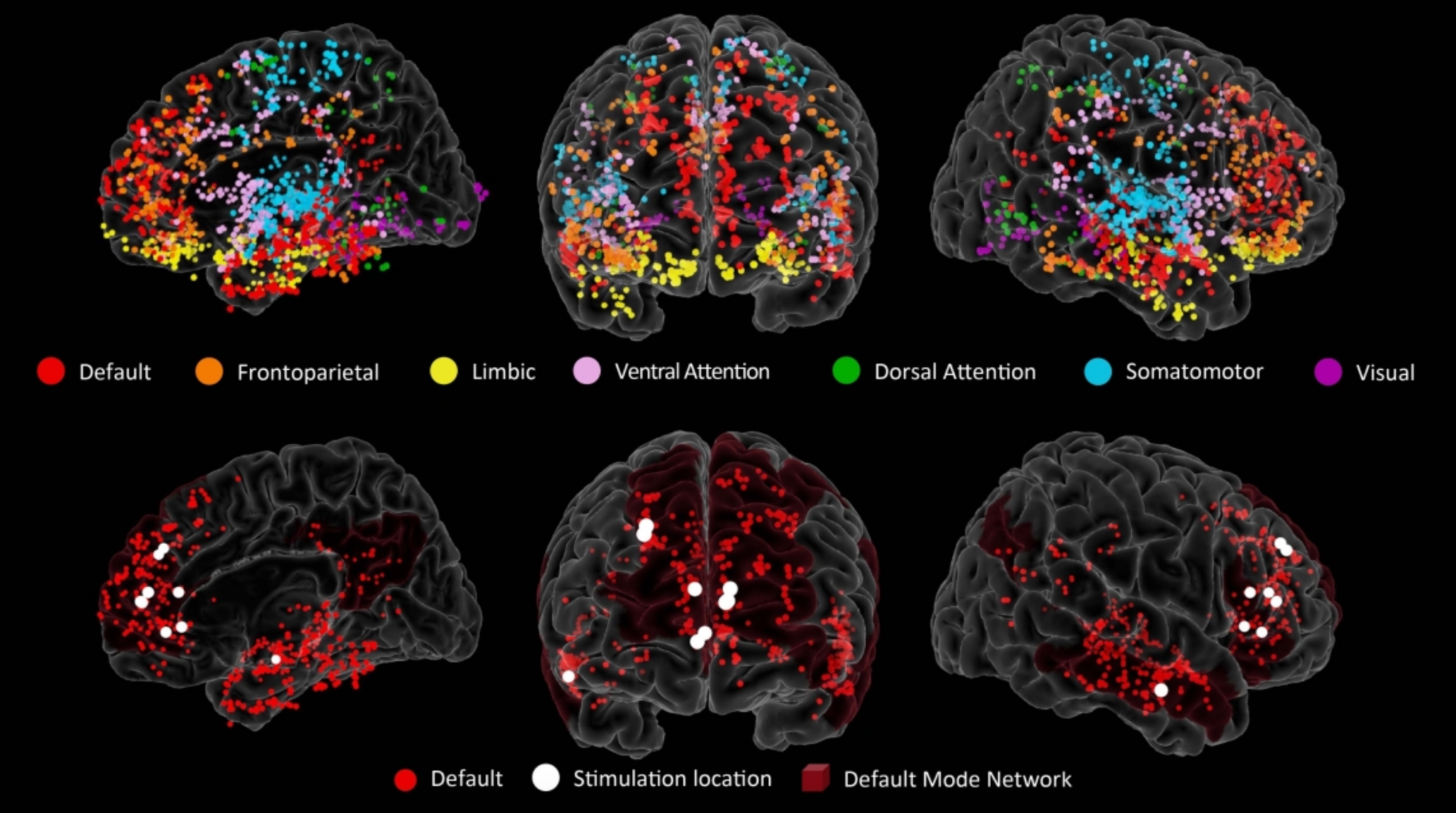 Scientists Identify Neural Network Vital For Creativity in The Brain ...