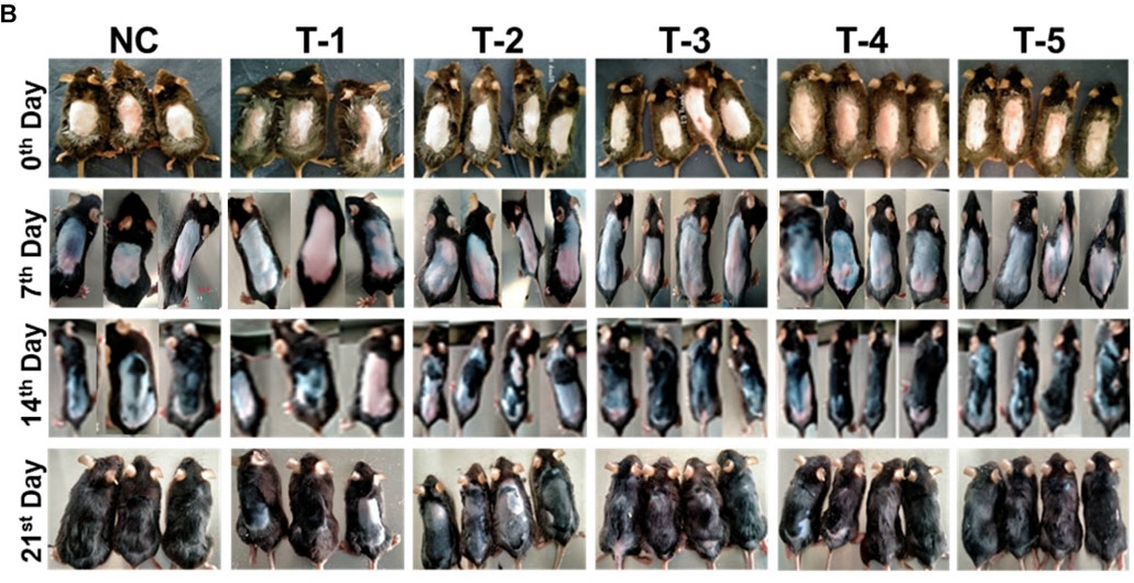 Surprise Hair Loss Breakthrough: A Sugar Gel Triggers Robust Regrowth ...