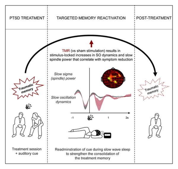 This Memory Exercise Could Help Reduce Severity of PTSD Symptoms ...