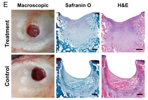 New Biomaterial Could Finally Repair Damaged Cartilage in Injured ...