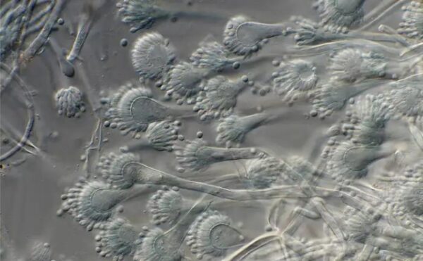 Deadly Fungal Infections Causing a 'Silent Pandemic', Scientists Warn ...