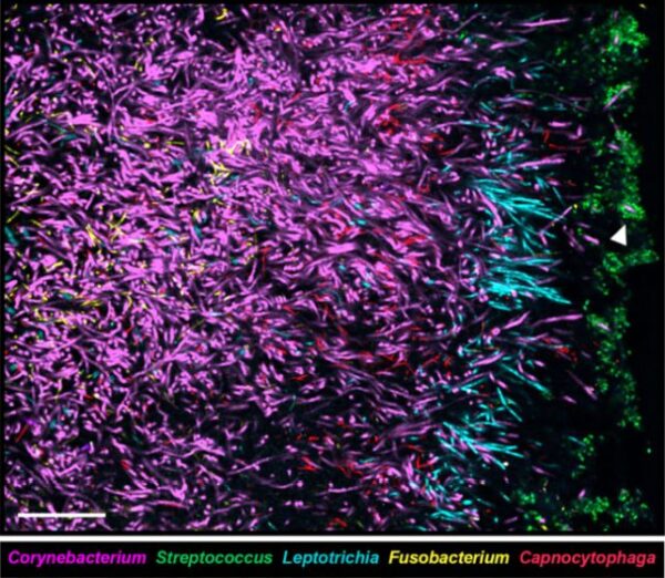 Bacteria in Your Mouth Reproduce in a Strange, Rare Way, Scientists ...