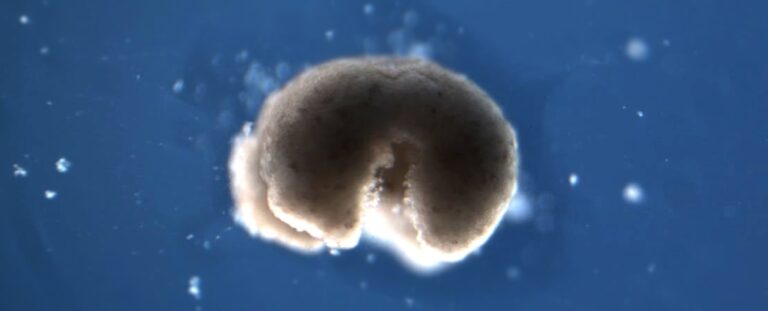These Creatures Occupy 'Third State' Beyond Life And Death, Scientists ... These Creatures Occupy 'Third State' Beyond Life And Death, Scientists ...