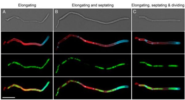 Bacteria in Your Mouth Reproduce in a Strange, Rare Way, Scientists ...